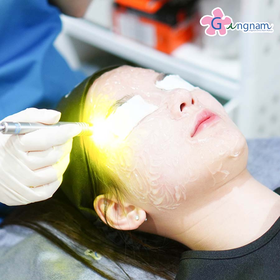 ข้อควรรู้ Dual Yellow Laser คืออะไร ช่วยให้หน้าใส รักษาสิวได้จริงไหม ...